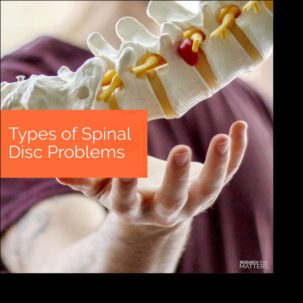Types of Spinal Disc Problems | Active Health Chiropractic